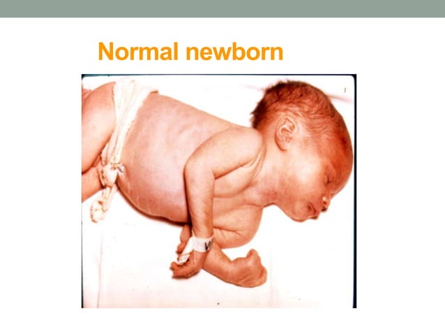 Normal Newborn & Common Neonatal problems.ppt