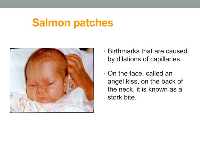 Normal Newborn & Common Neonatal problems.ppt