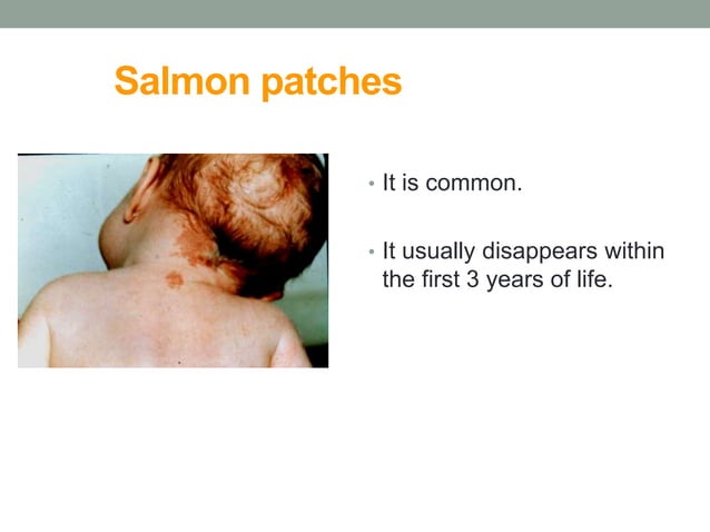 Normal Newborn & Common Neonatal problems.ppt