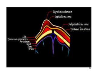 Normal newborn pp_final | PPT
