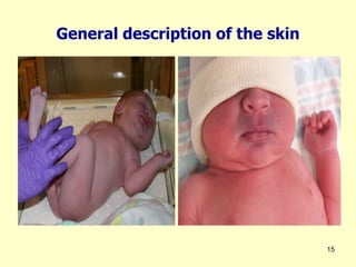 Normal newborn pp_final | PPT