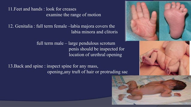 normal newborn ppt by Shrutika Dhongade.pptx