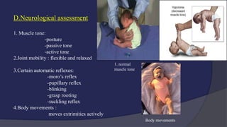 normal newborn ppt by Shrutika Dhongade.pptx