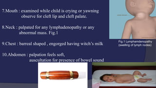 normal newborn ppt by Shrutika Dhongade.pptx