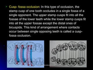 Normal occlusion | PPT
