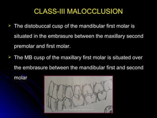 Normal occlusion | PPT