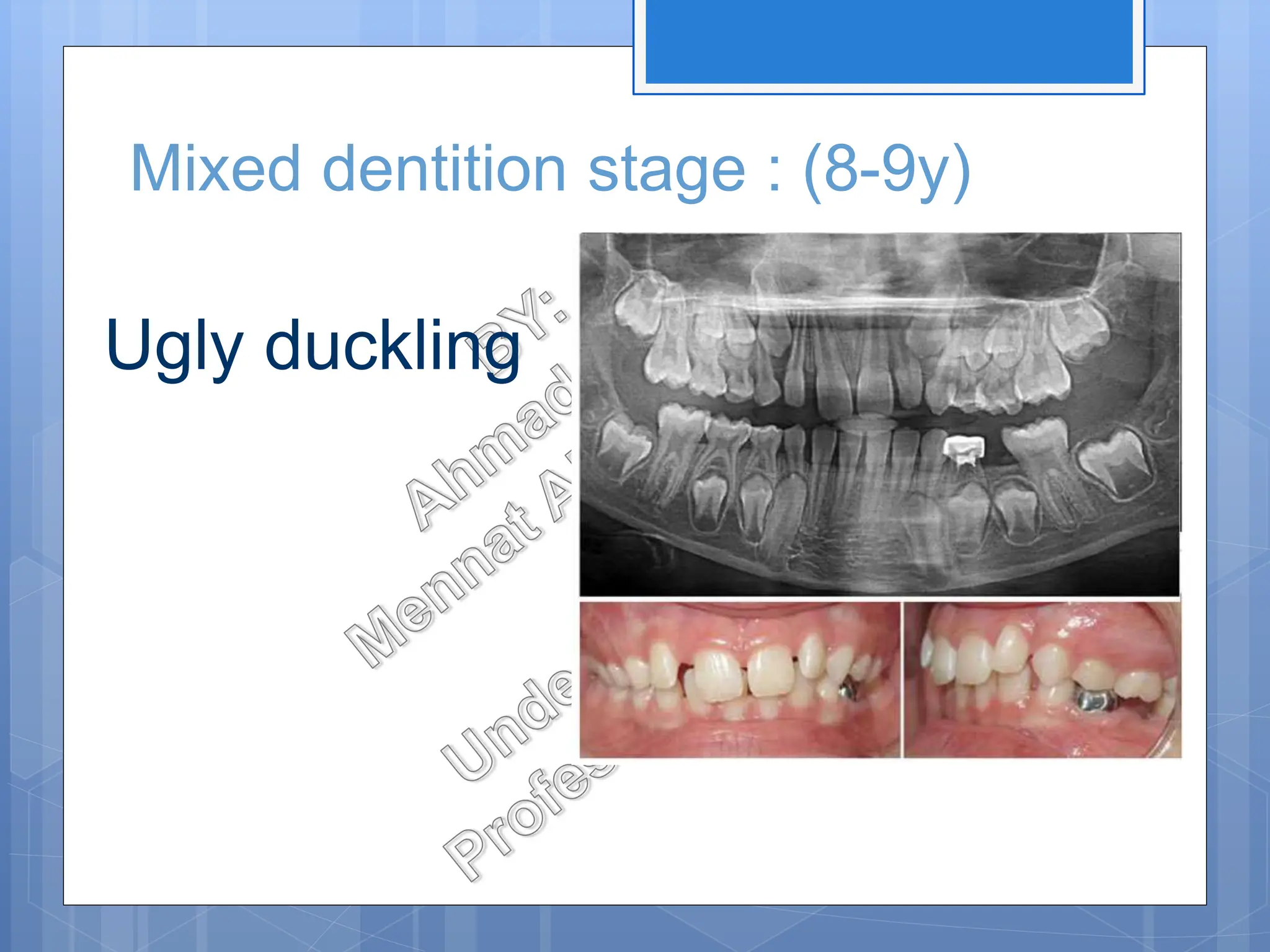Development of normal dental occlusion in children.pptx | Free Download
