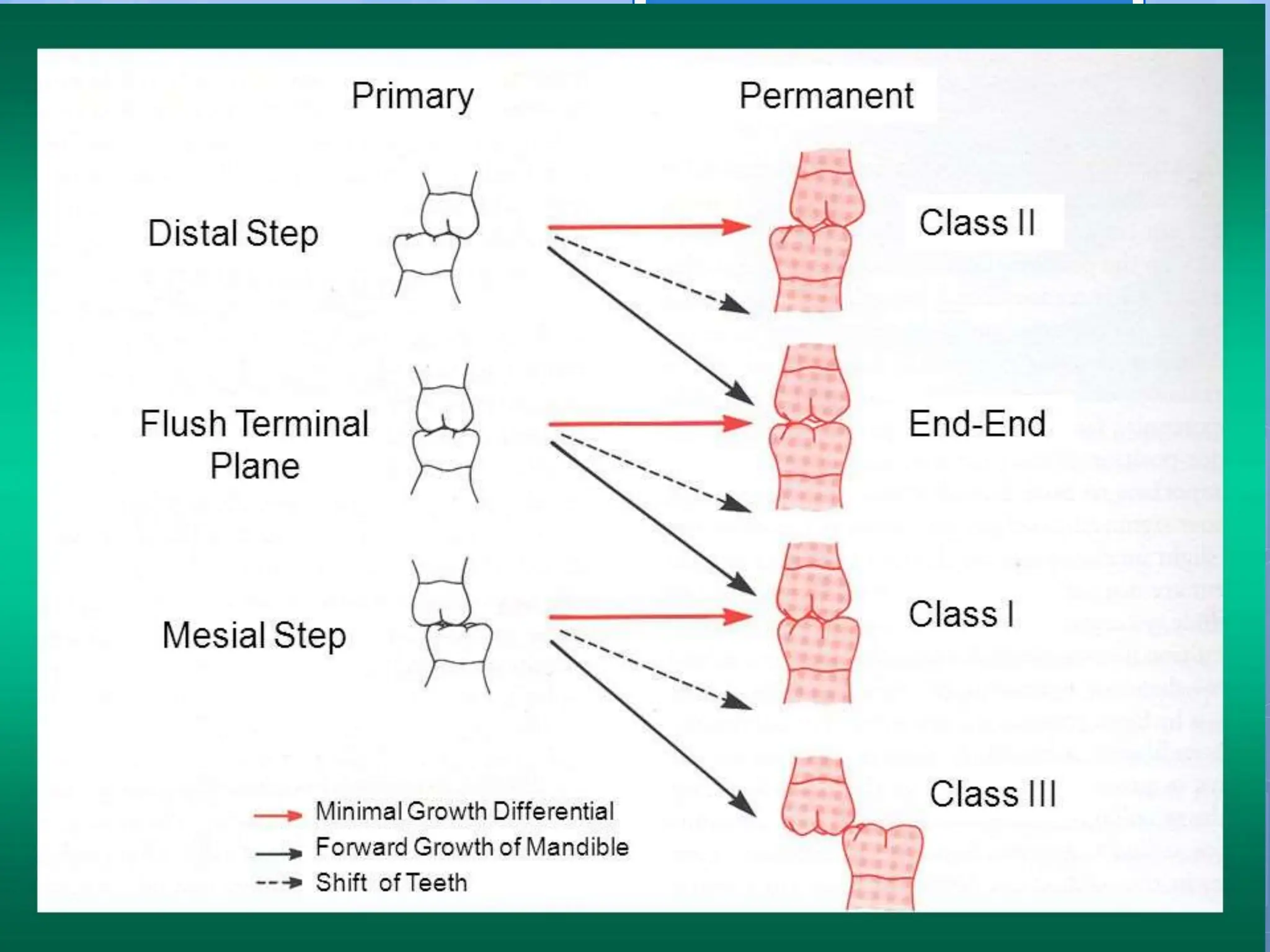 Development of normal dental occlusion in children.pptx