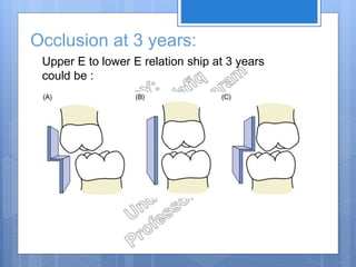 Development of normal dental occlusion in children.pptx | Free Download
