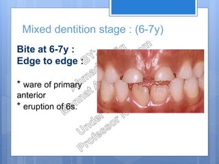 Development of normal dental occlusion in children.pptx | Free Download