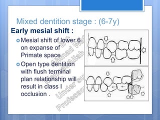 Development of normal dental occlusion in children.pptx