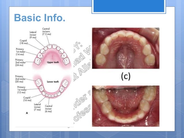 Development of normal dental occlusion in children.pptx | Free Download