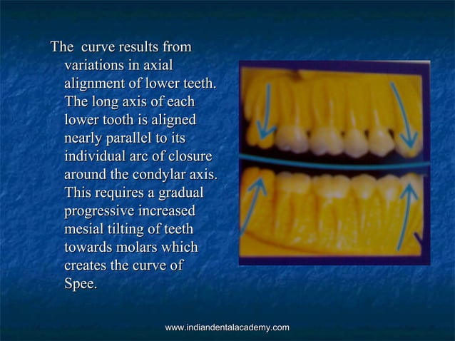 Normal occlusion (2)