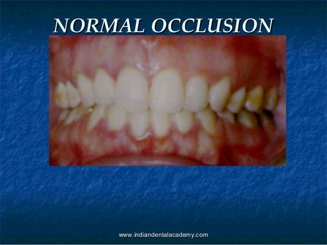 Normal occlusion (2)