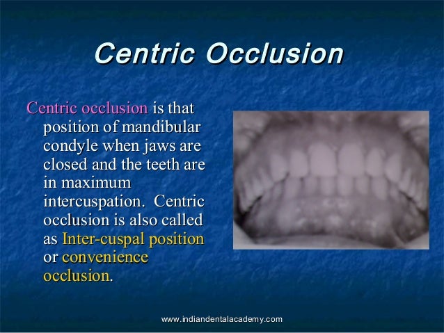 Normal occlusion (2)