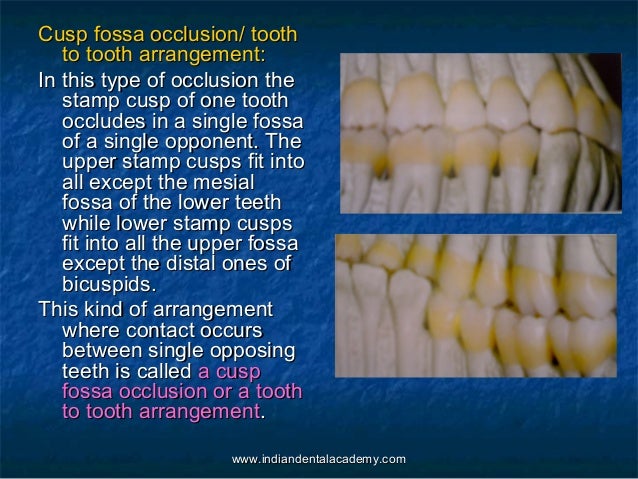 Normal occlusion (2)
