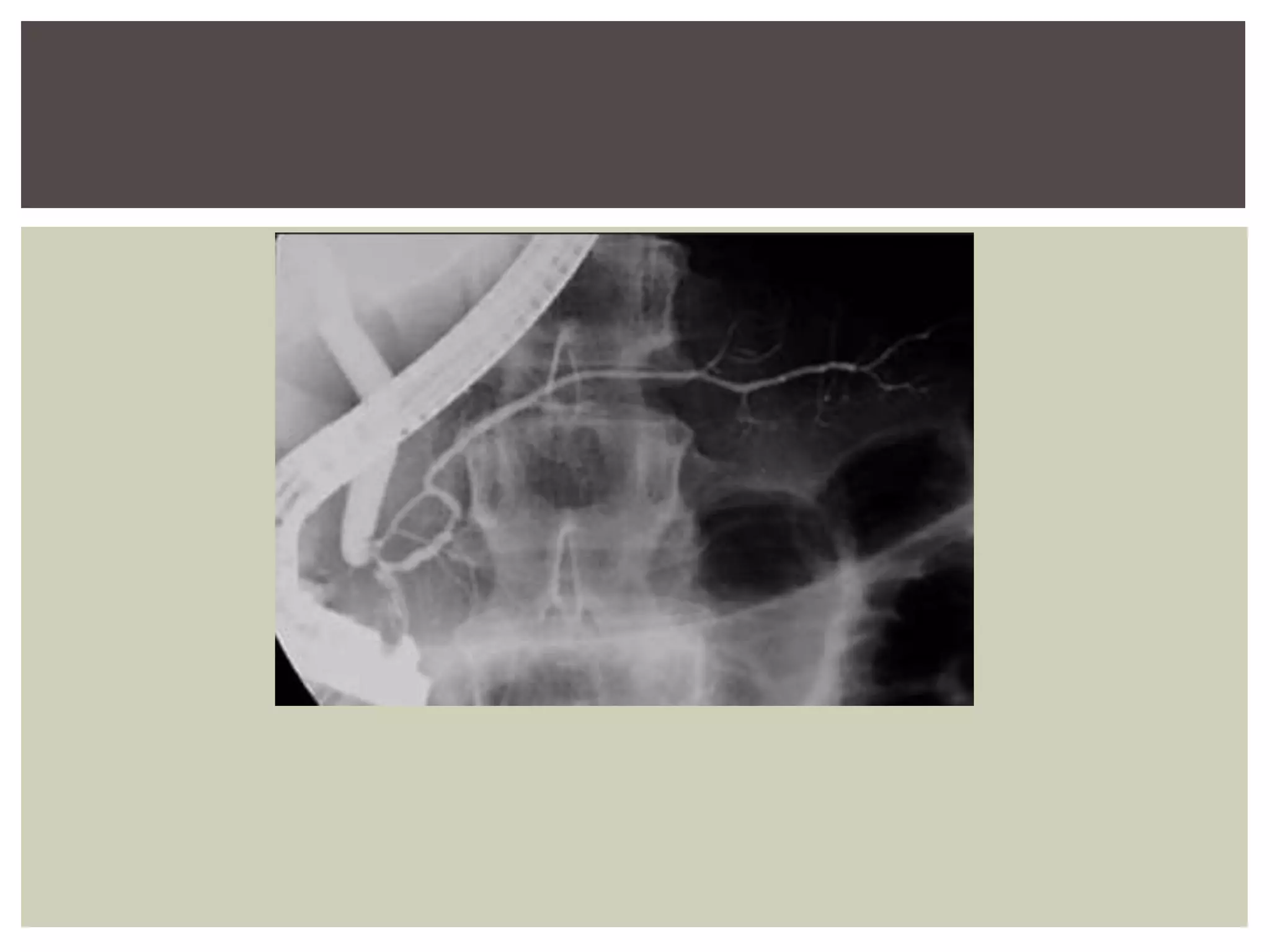 Normal pancreatic anatomy and anatomical variations | PPT