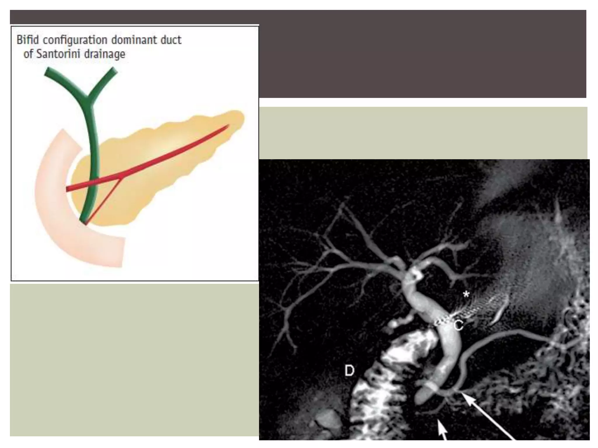 Normal pancreatic anatomy and anatomical variations | PPT