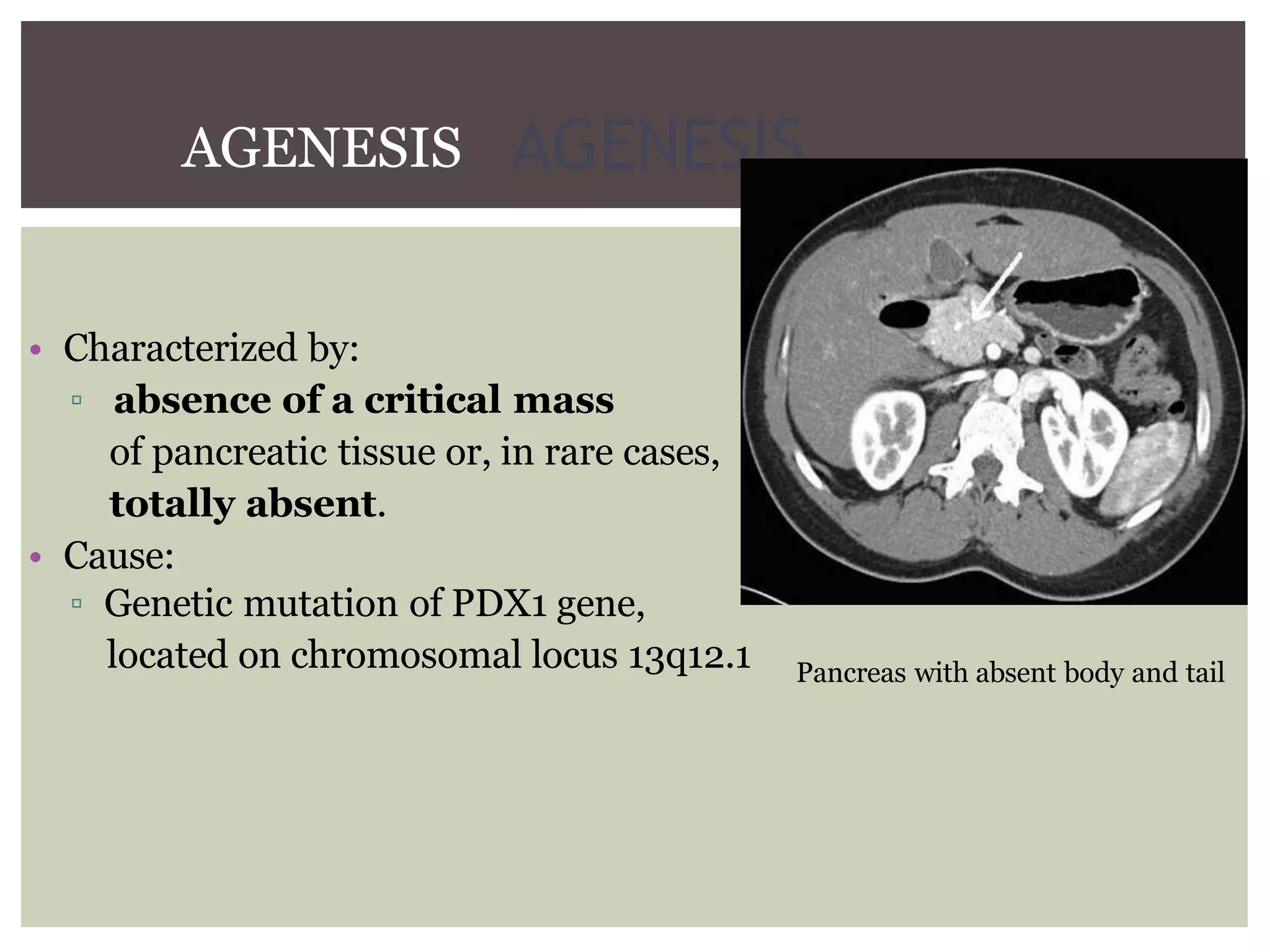 Normal pancreatic anatomy and anatomical variations | PPT