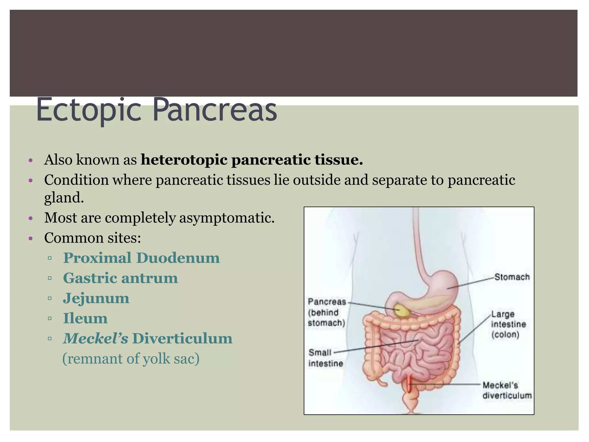 Normal pancreatic anatomy and anatomical variations | PPT