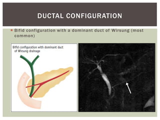 Normal pancreatic anatomy and anatomical variations | PPT