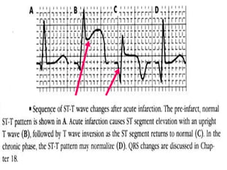 Normal Pattern rev.ppt cek dan belajar bersama | PPT