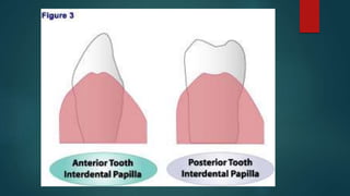 Normal periodontium | PPTX