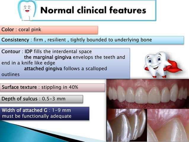 Normal periodontium | PPTX | Dental Health | Diseases and Conditions
