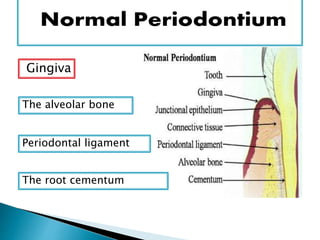 Normal periodontium