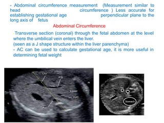 Normal Pregnancy Ultrasound- signs of yearly pregnancy , 2 and 3 ...