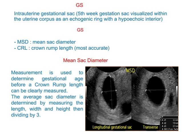 Normal Pregnancy Ultrasound- signs of yearly pregnancy , 2 and 3 ...