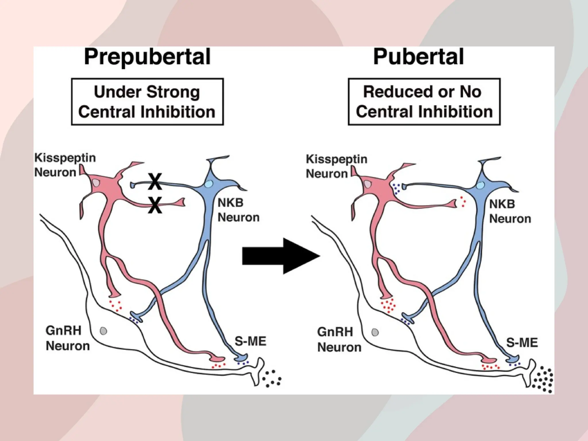 “Understanding Normal Puberty: A Comprehensive Exploration of the ...