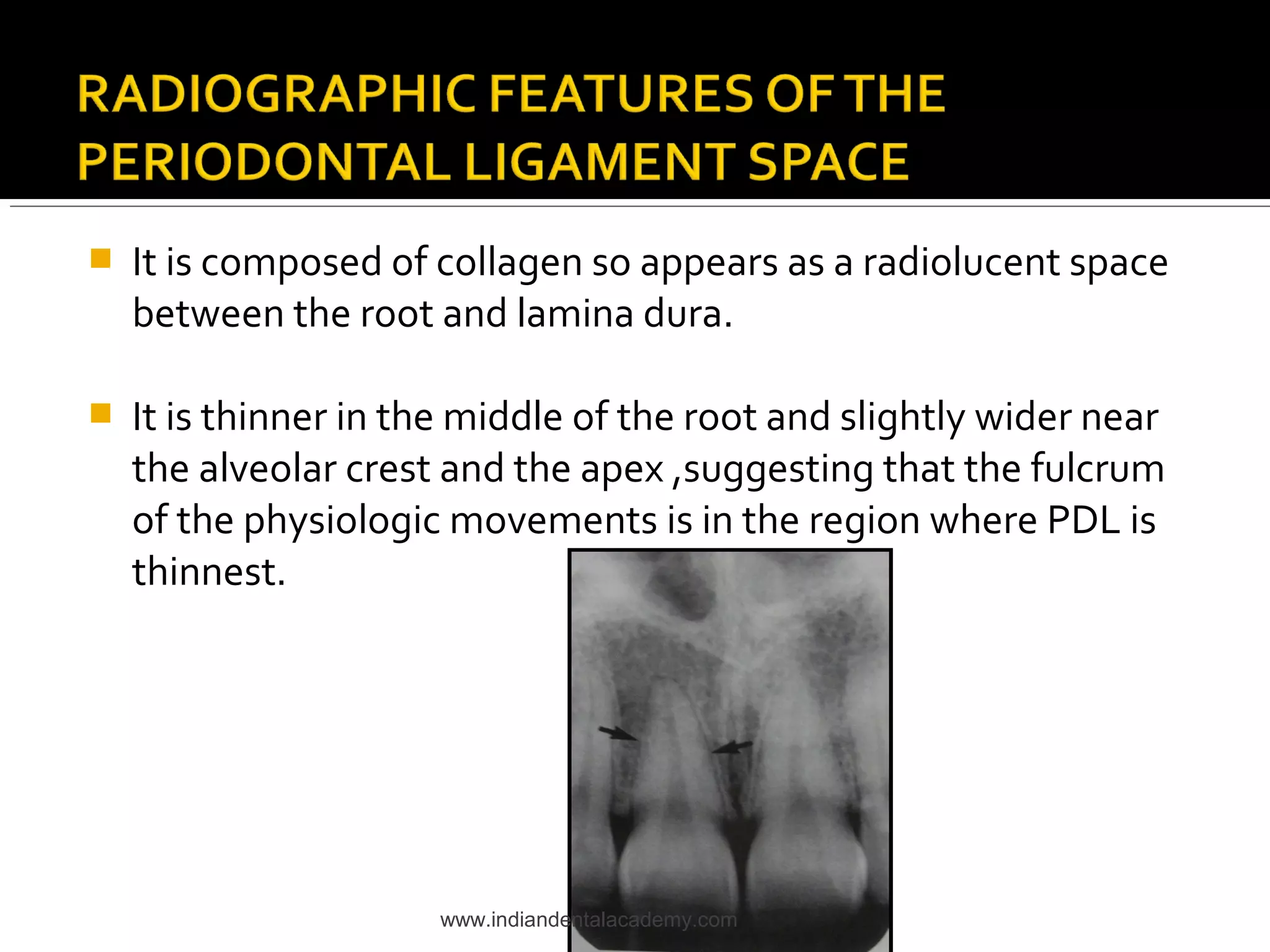 Normal radiographic anatomical landmarks / dental courses | PPT