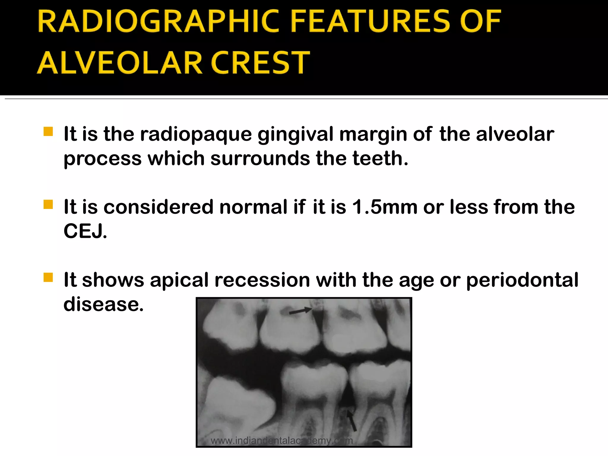 Normal radiographic anatomical landmarks / dental courses | PPT