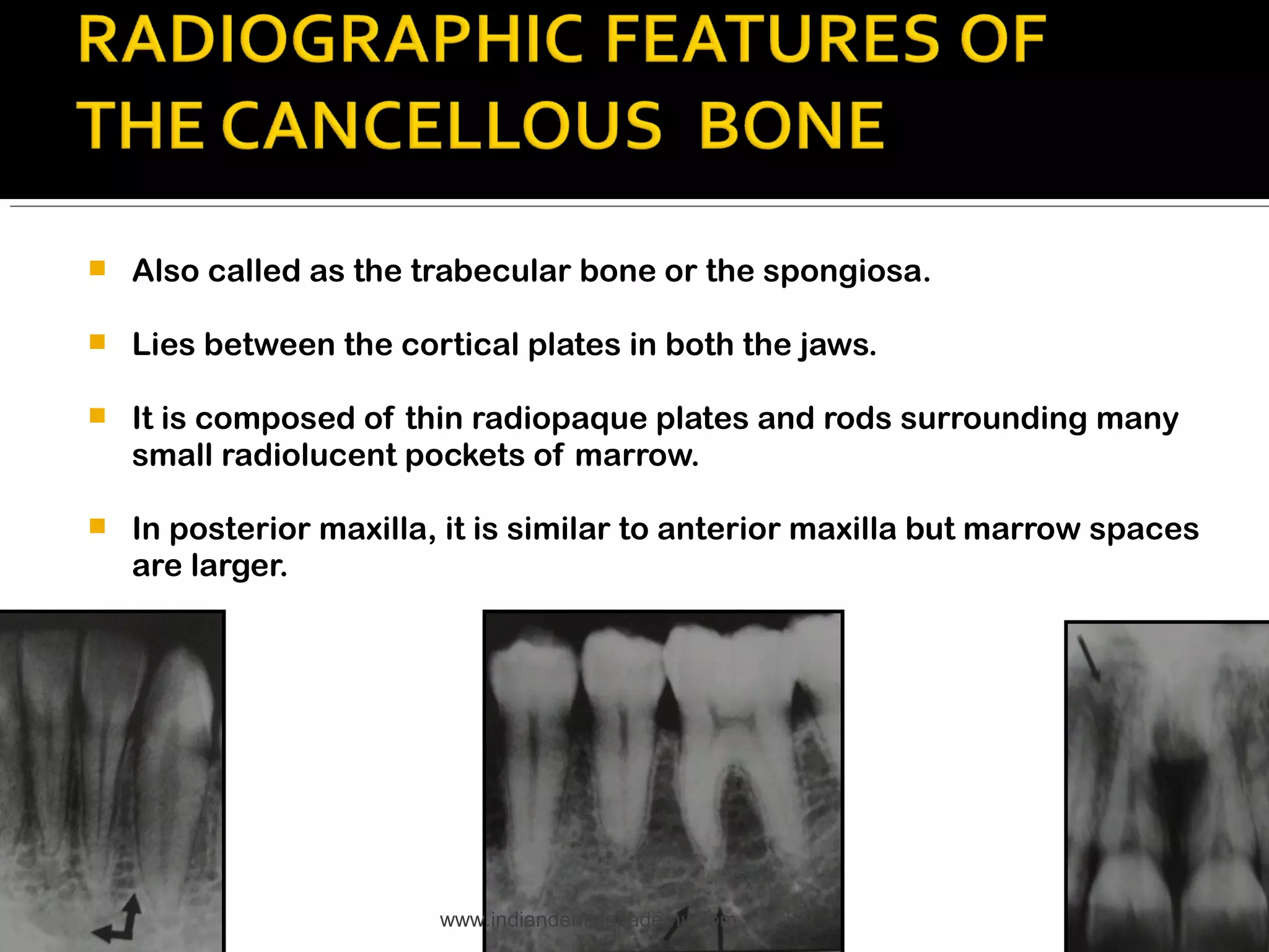 Normal radiographic anatomical landmarks / dental courses | PPT