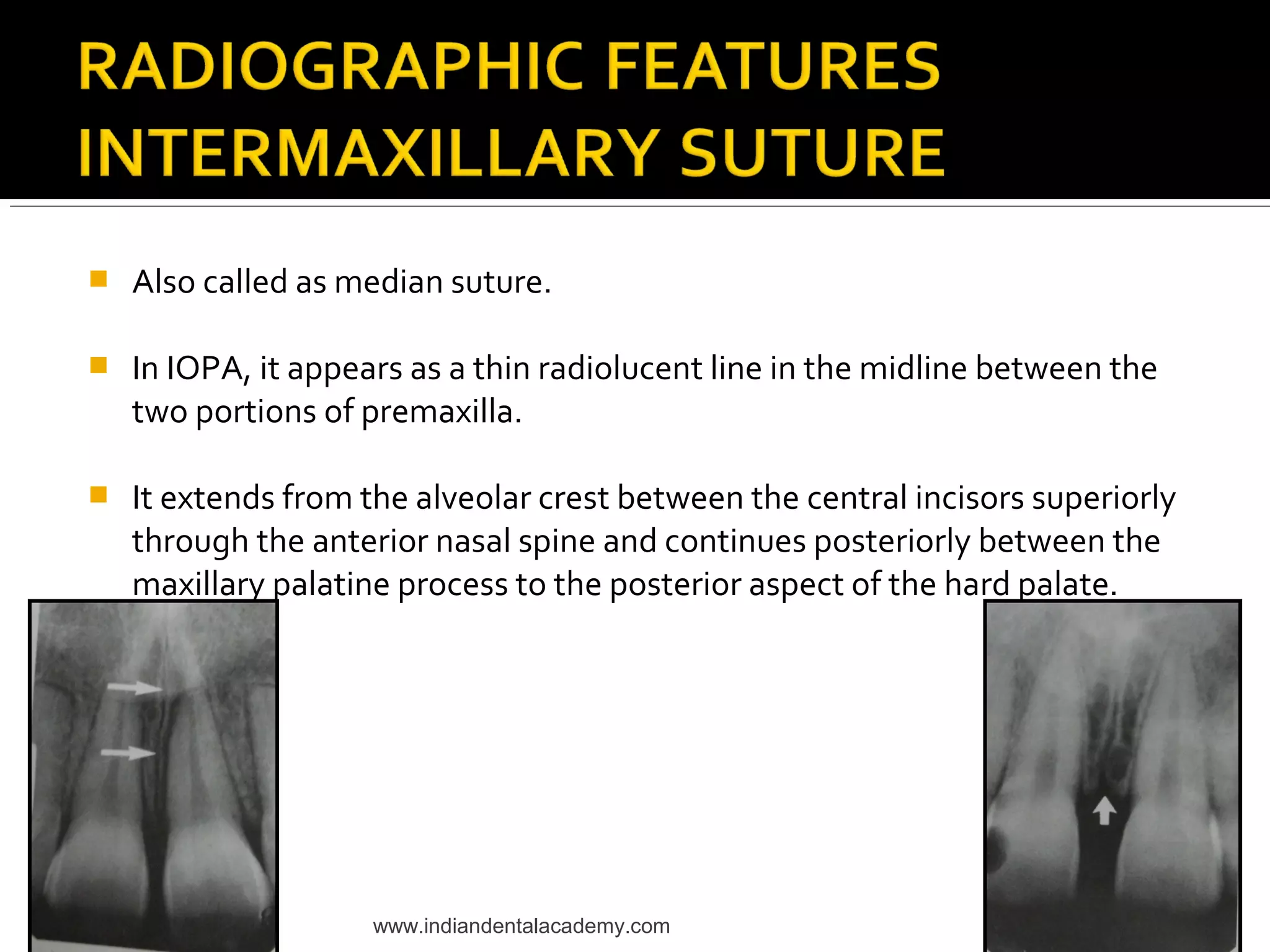 Normal radiographic anatomical landmarks / dental courses | PPT