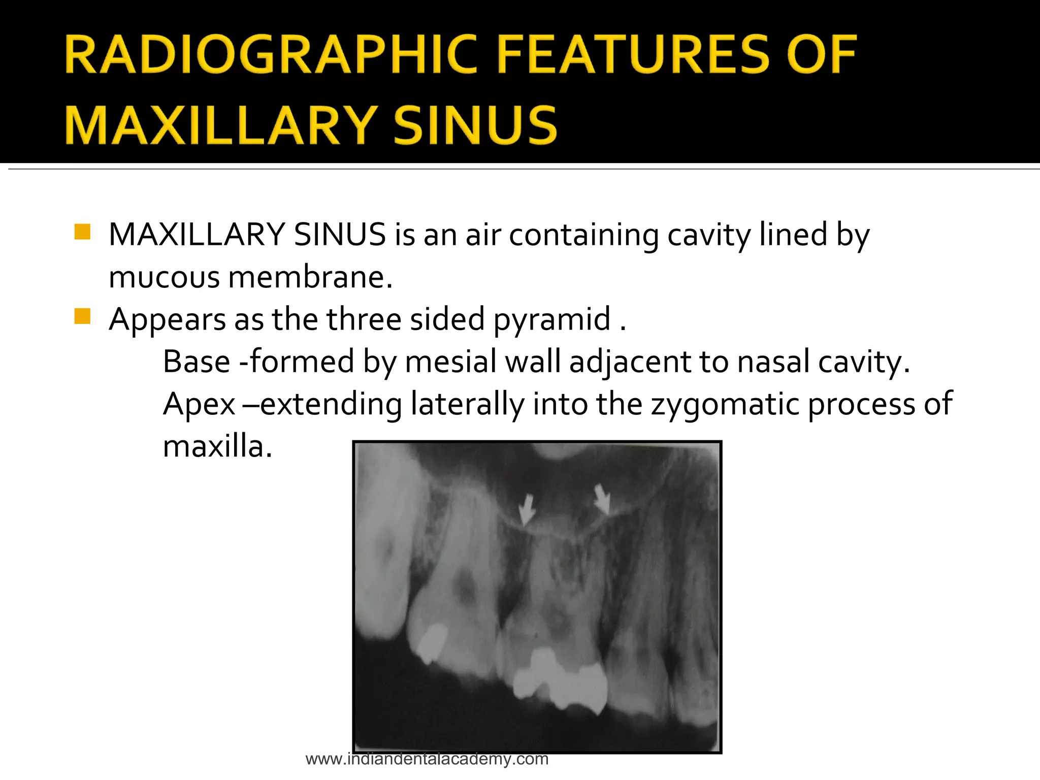 Normal radiographic anatomical landmarks / dental courses | PPT ...
