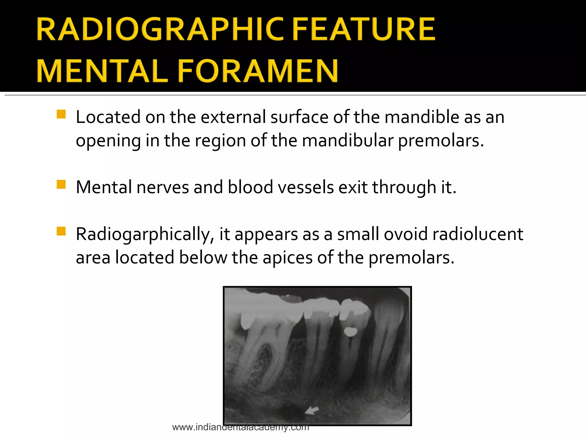 Normal radiographic anatomical landmarks / dental courses | PPT