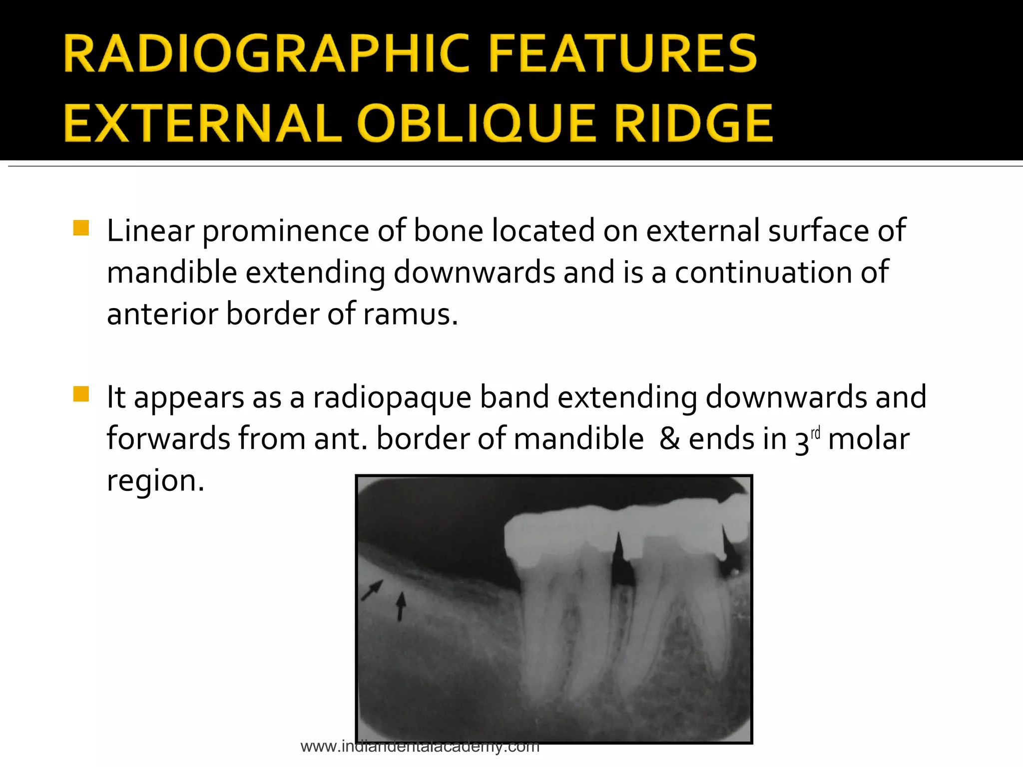 Normal radiographic anatomical landmarks / dental courses | PPT