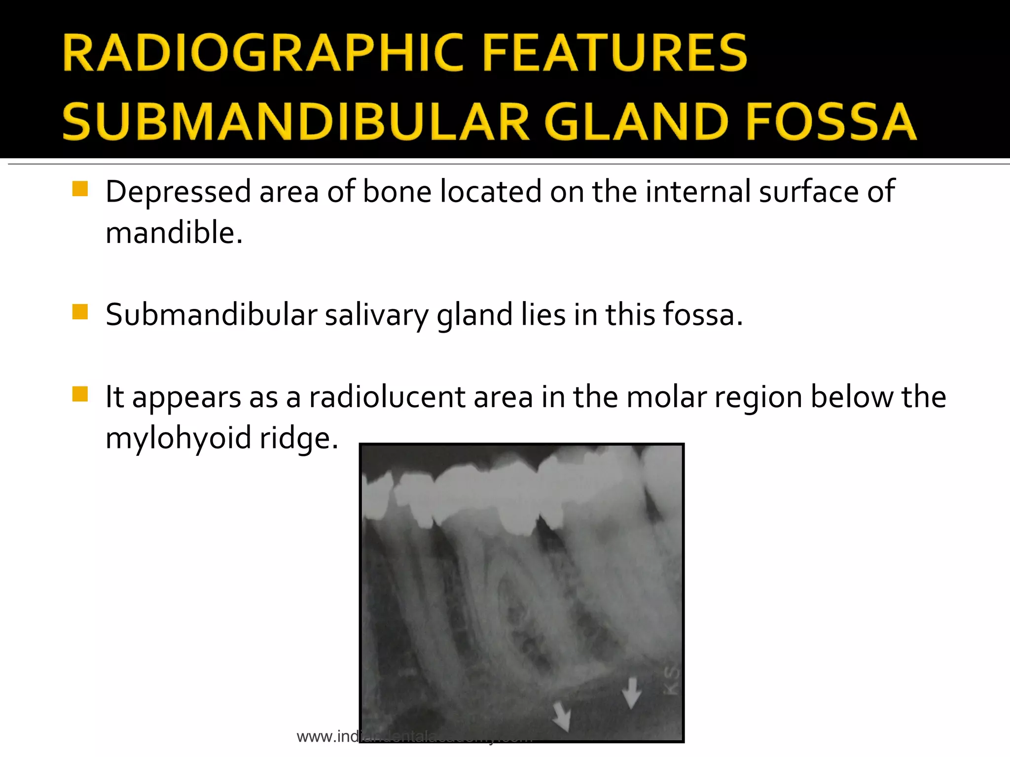 Normal radiographic anatomical landmarks / dental courses | PPT