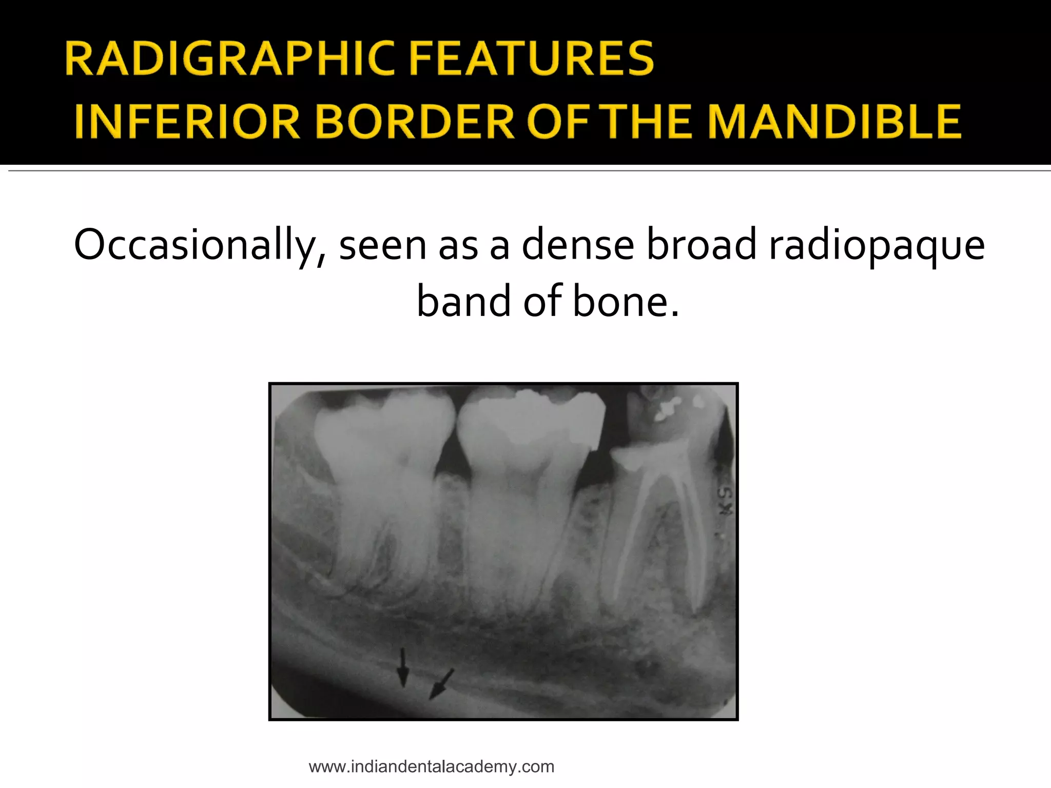 Normal radiographic anatomical landmarks / dental courses | PPT