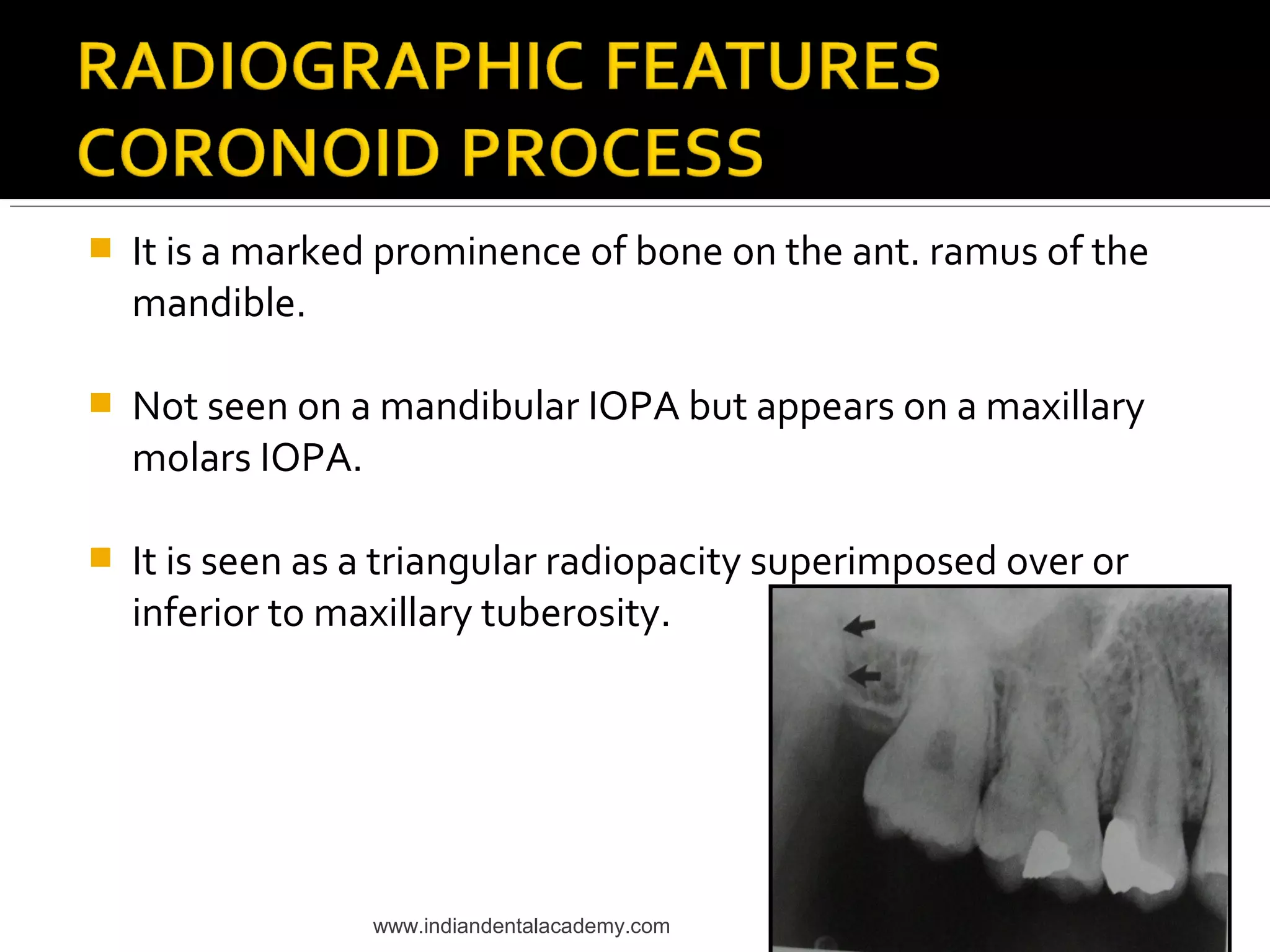 Normal radiographic anatomical landmarks / dental courses | PPT