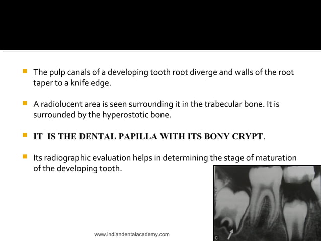 Normal radiographic anatomical landmarks / dental courses | PPT ...
