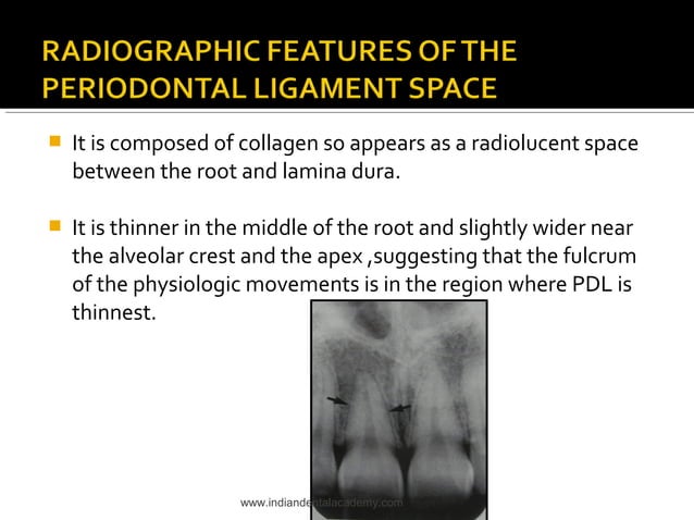 Normal radiographic anatomical landmarks / dental courses | PPT ...