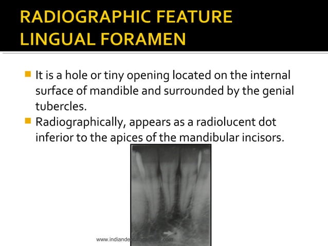 Normal radiographic anatomical landmarks / dental courses | PPT ...
