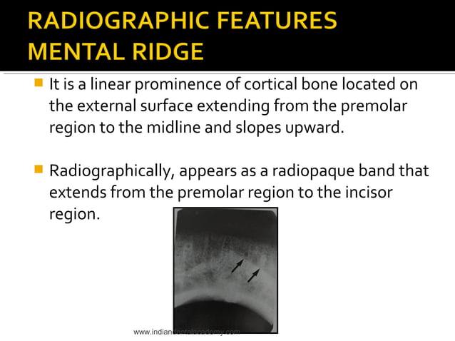Normal radiographic anatomical landmarks / dental courses | PPT ...