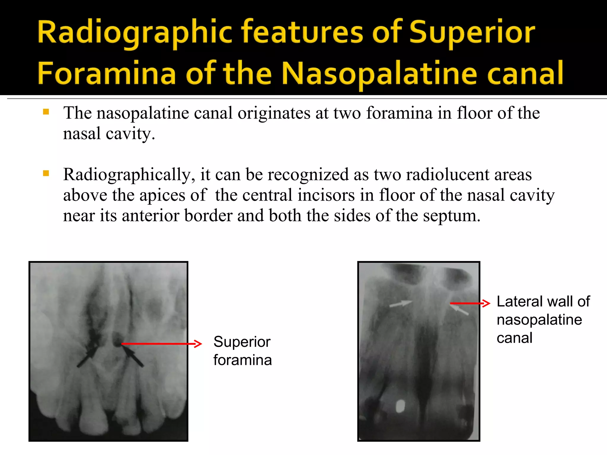 Normal Radiographic Anatomy | PPT