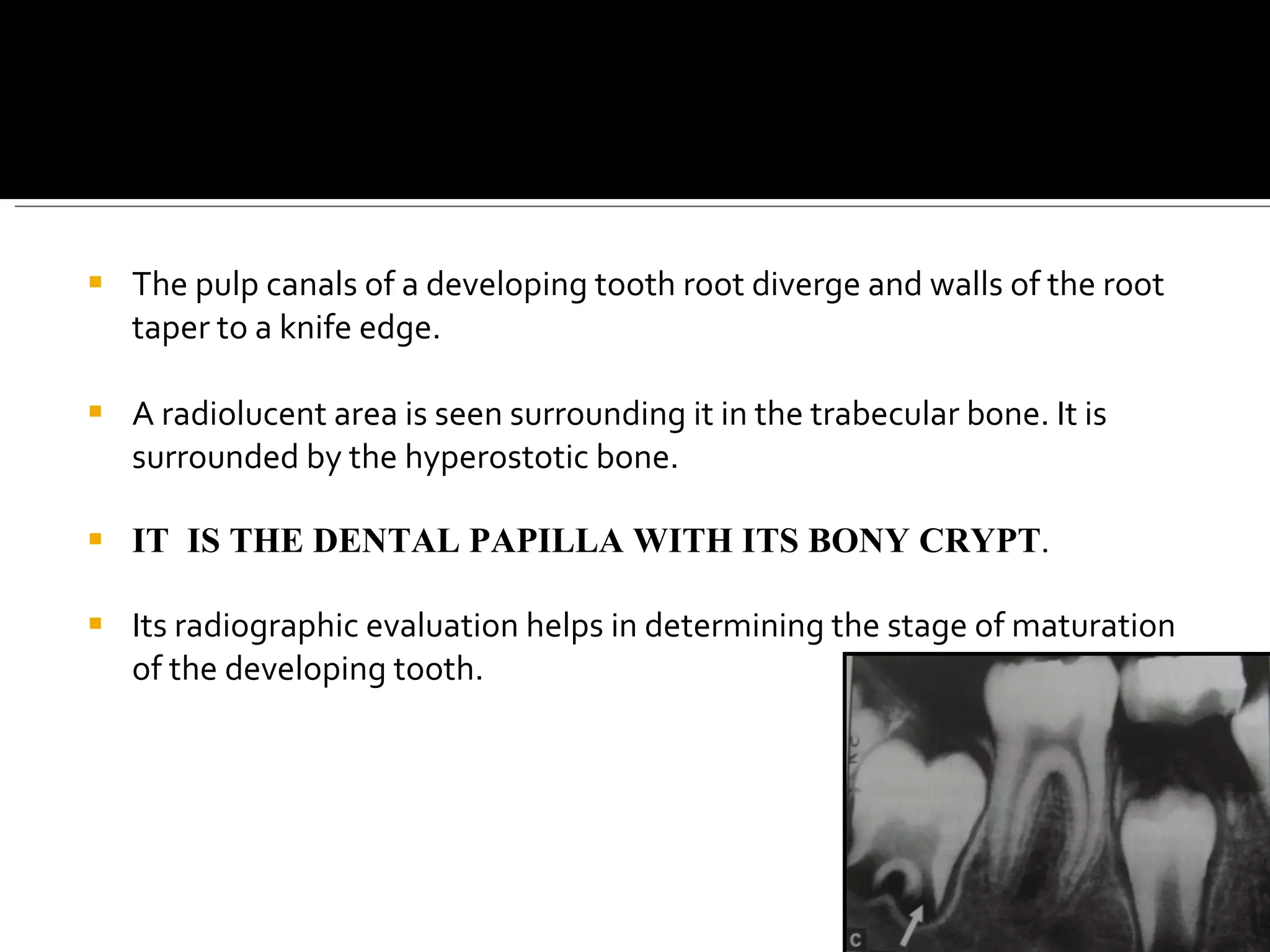 Normal Radiographic Anatomy | PPT