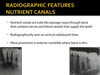 Nutrient Canal Radiograph