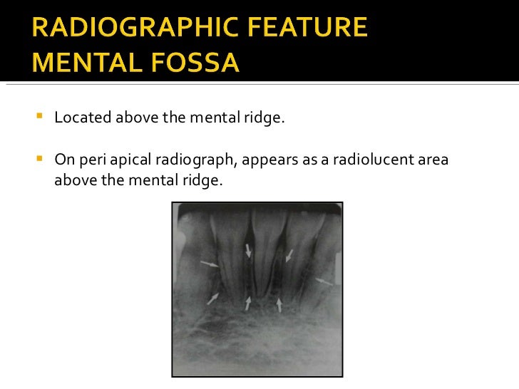 Mental Fossa Radiograph